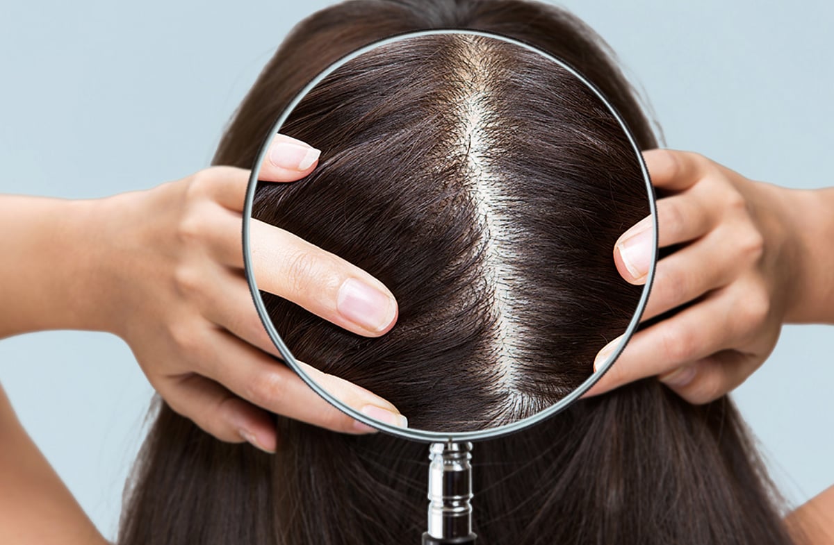 Is your scalp stressed out too? The surprising link between anxiety and ...