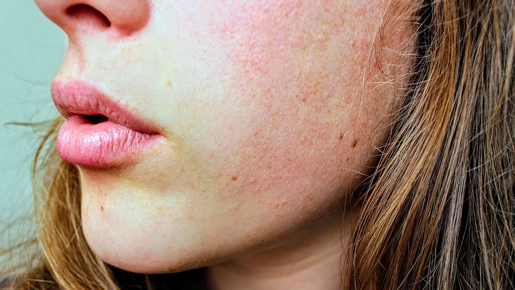 How to spot the difference between dry and dehydrated skin