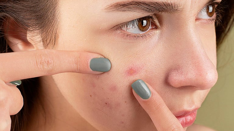Do pimple patches really help with faster healing?