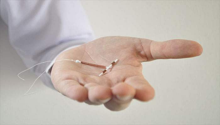 IUDs may prevent cervical cancer risk